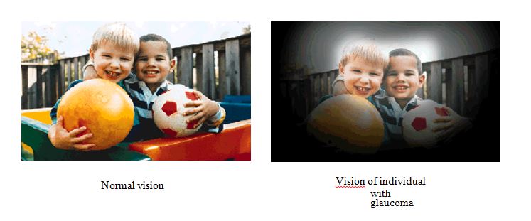 22 - Vision impairments - CCMTA Medical Standards - Province of British Columbia