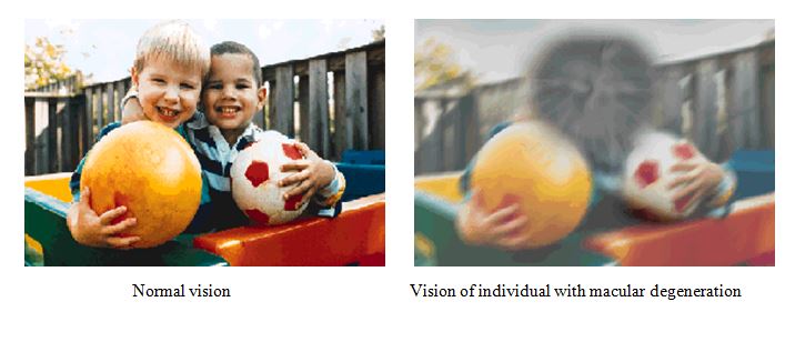 22 - Vision impairments - CCMTA Medical Standards - Province of British ...